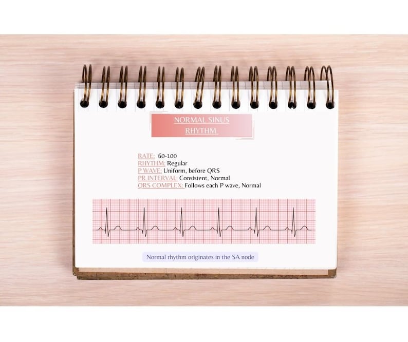 The Basics: EKG Interpretation Resource Guide - Etsy