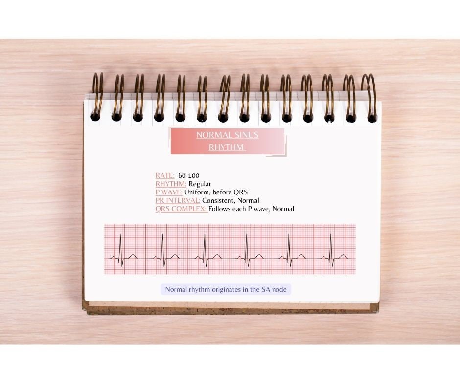 The Basics: EKG Interpretation Resource Guide - Etsy