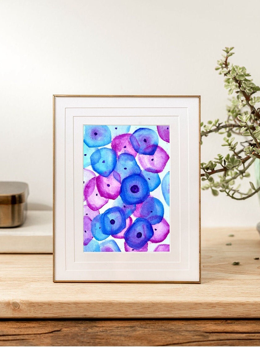 Pathology Art Print: Koilocytes, PAP Smear, LSIL - Etsy