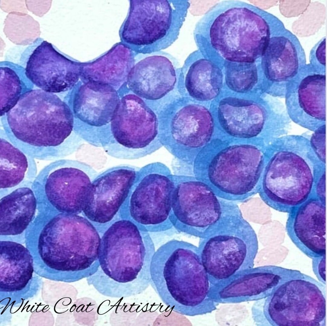 Pathology-inspired Art – Lung Cancer Cytology, 7x10 Watercolor Painting ...