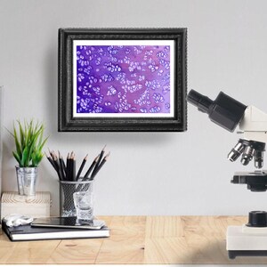 Cartilage Pathology Art Print, Bone Histology - Etsy