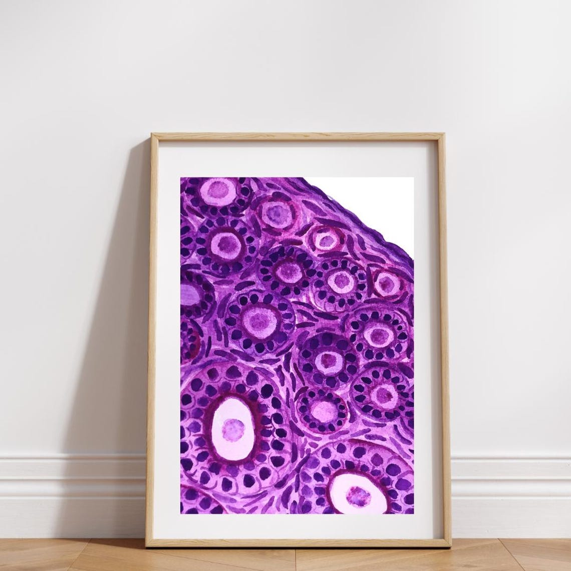 Ovary Pathology Print, Histology Art, Medical Art, Gift for Doctor - Etsy