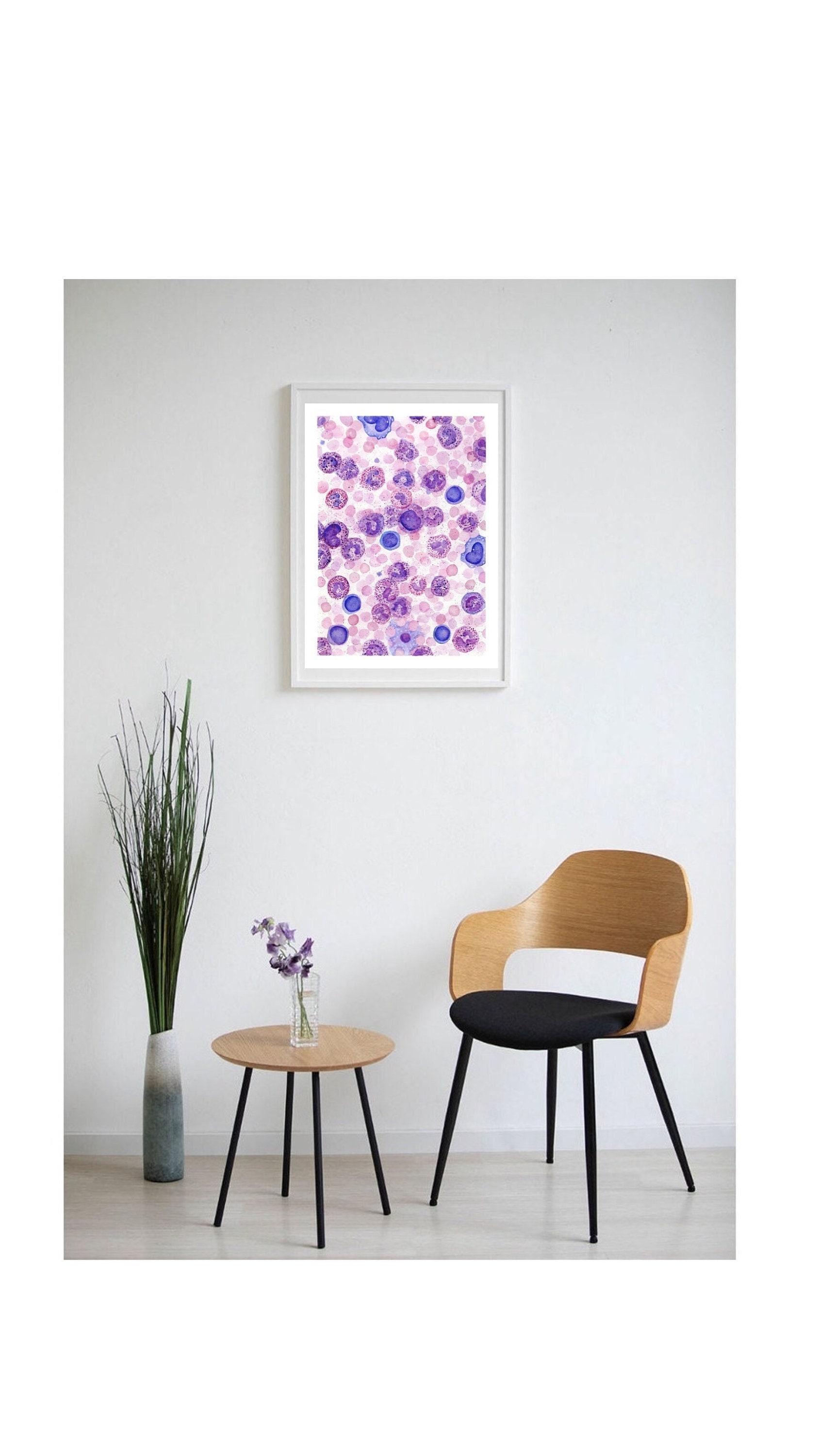 Chronic Myeloid Leukemia, Pathology Art Print - Etsy