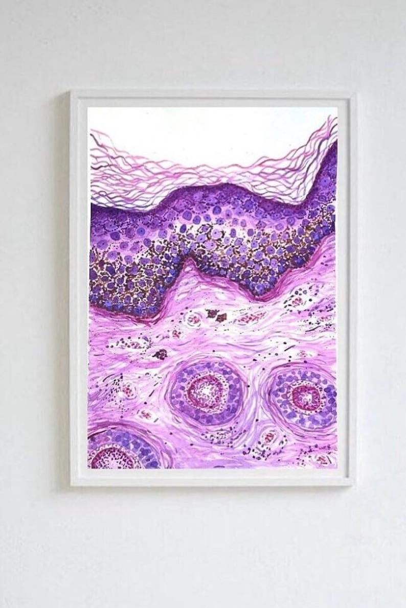 Skin Under the Microscope – Melanin, Dermatology, Pathology Art Print ...