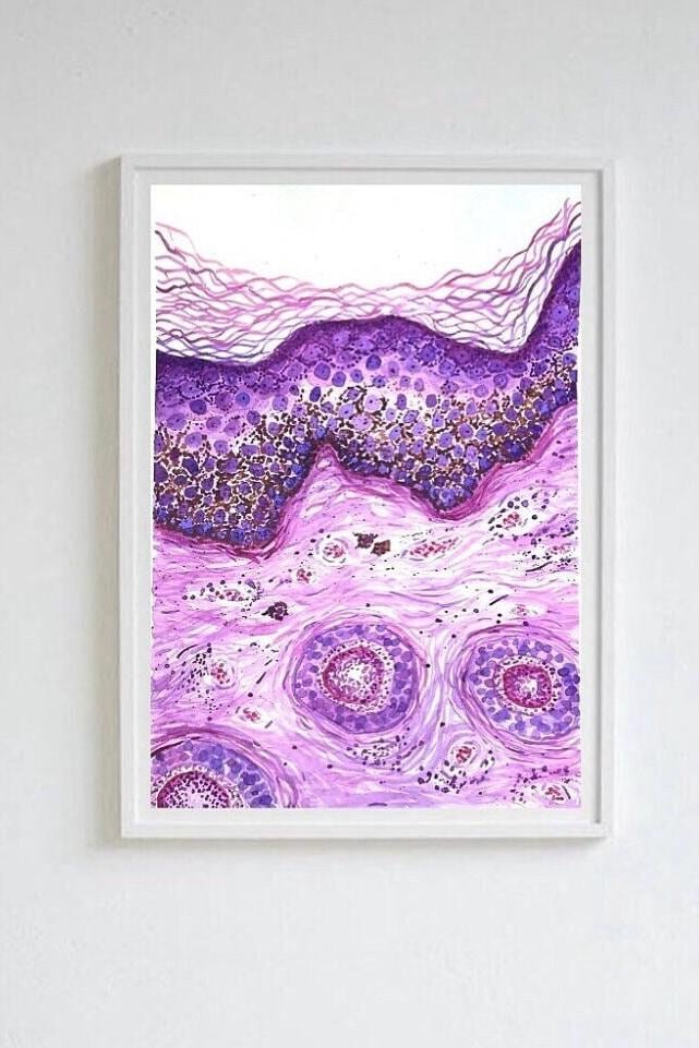 Skin Under the Microscope – Melanin, Dermatology, Pathology Art Print ...