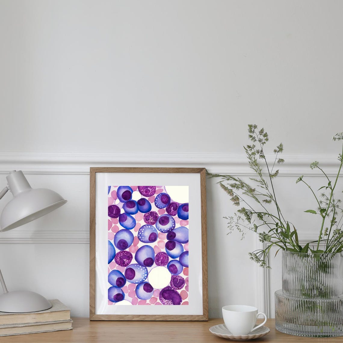 Hematopathology Art Print – Customer Favorite, Multiple Myeloma & Blood ...