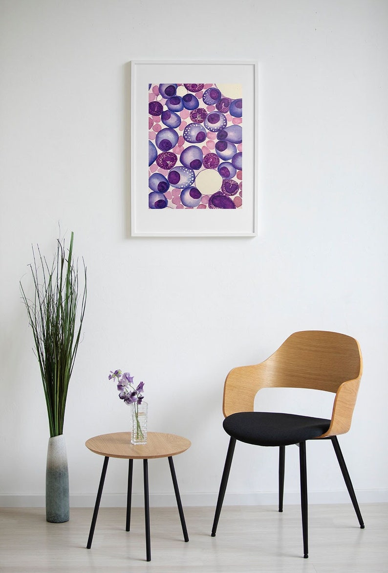 Hematopathology Art Print – Customer Favorite, Multiple Myeloma & Blood ...