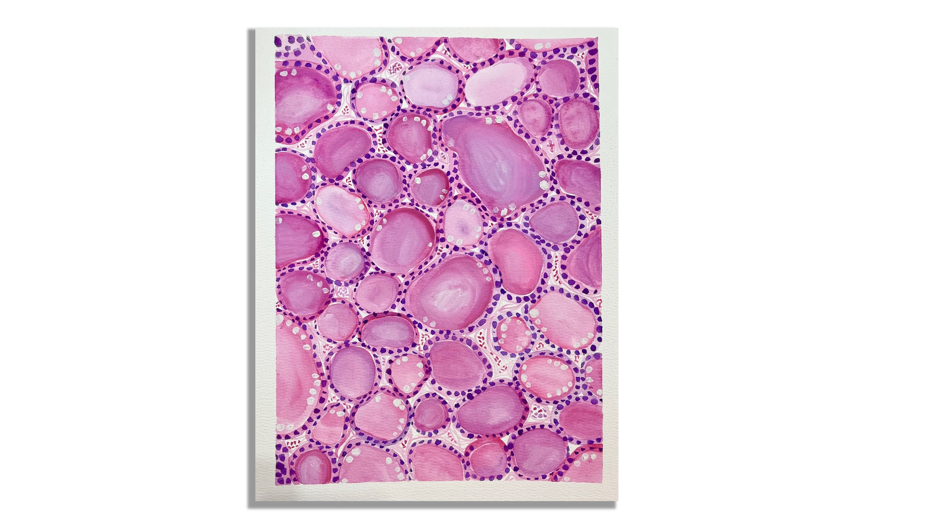 Thyroid, Pathology Art Original Painting, Watercolor and Gouache, 9x12 ...
