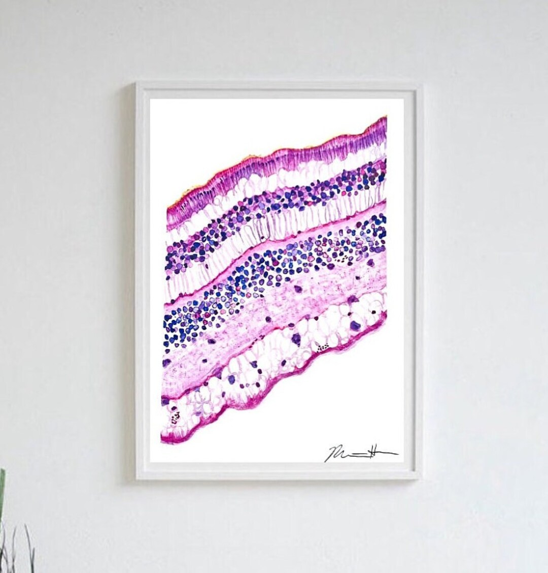 Retina, Original Pathology Art Watercolor Painting, 7"x10" - Etsy
