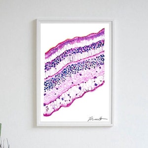 Retina, Original Pathology Art Watercolor Painting, 7"x10" - Etsy