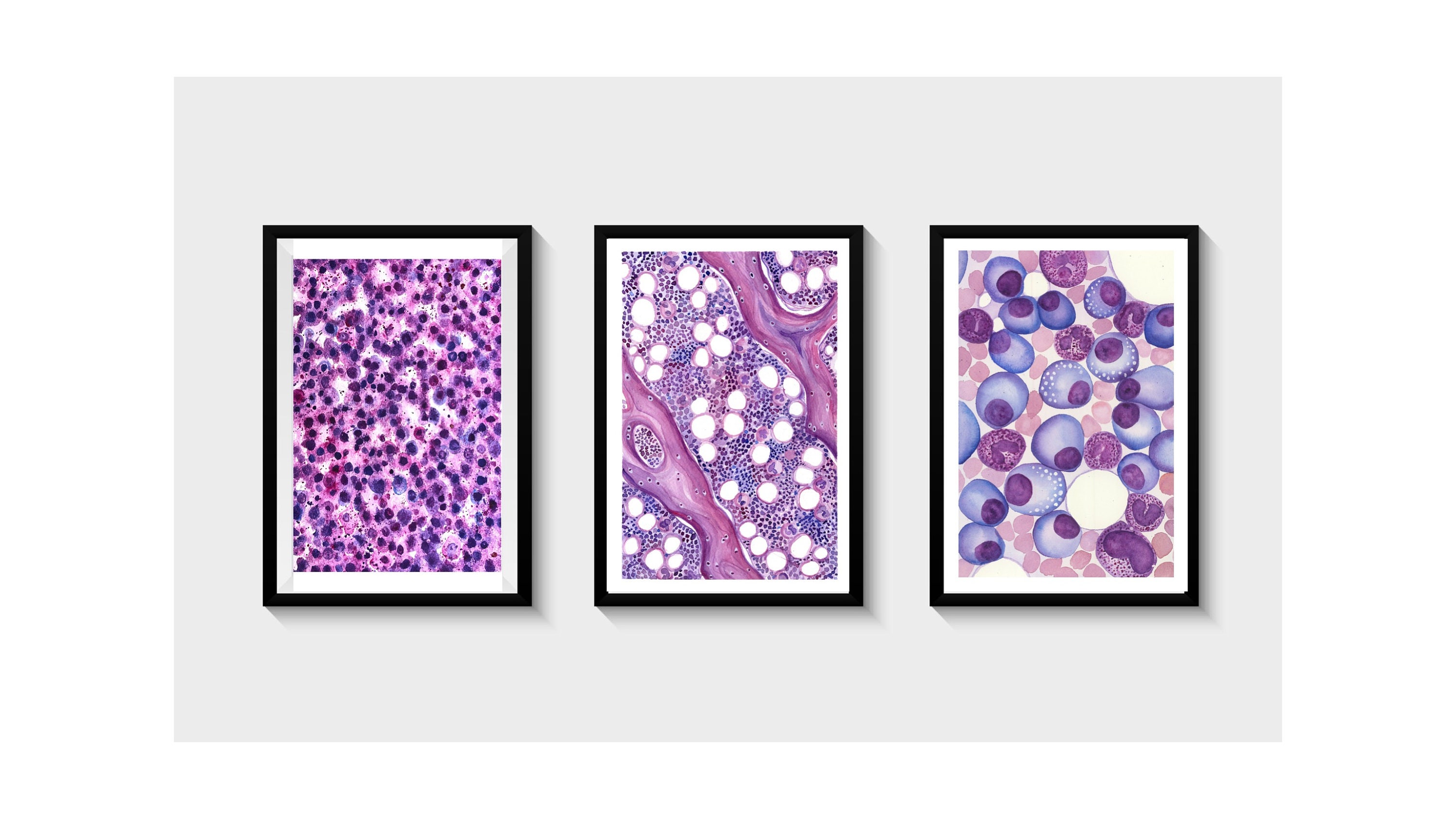 Bone Marrow Hematopathology Print – Customer Favorite Pathology Art ...