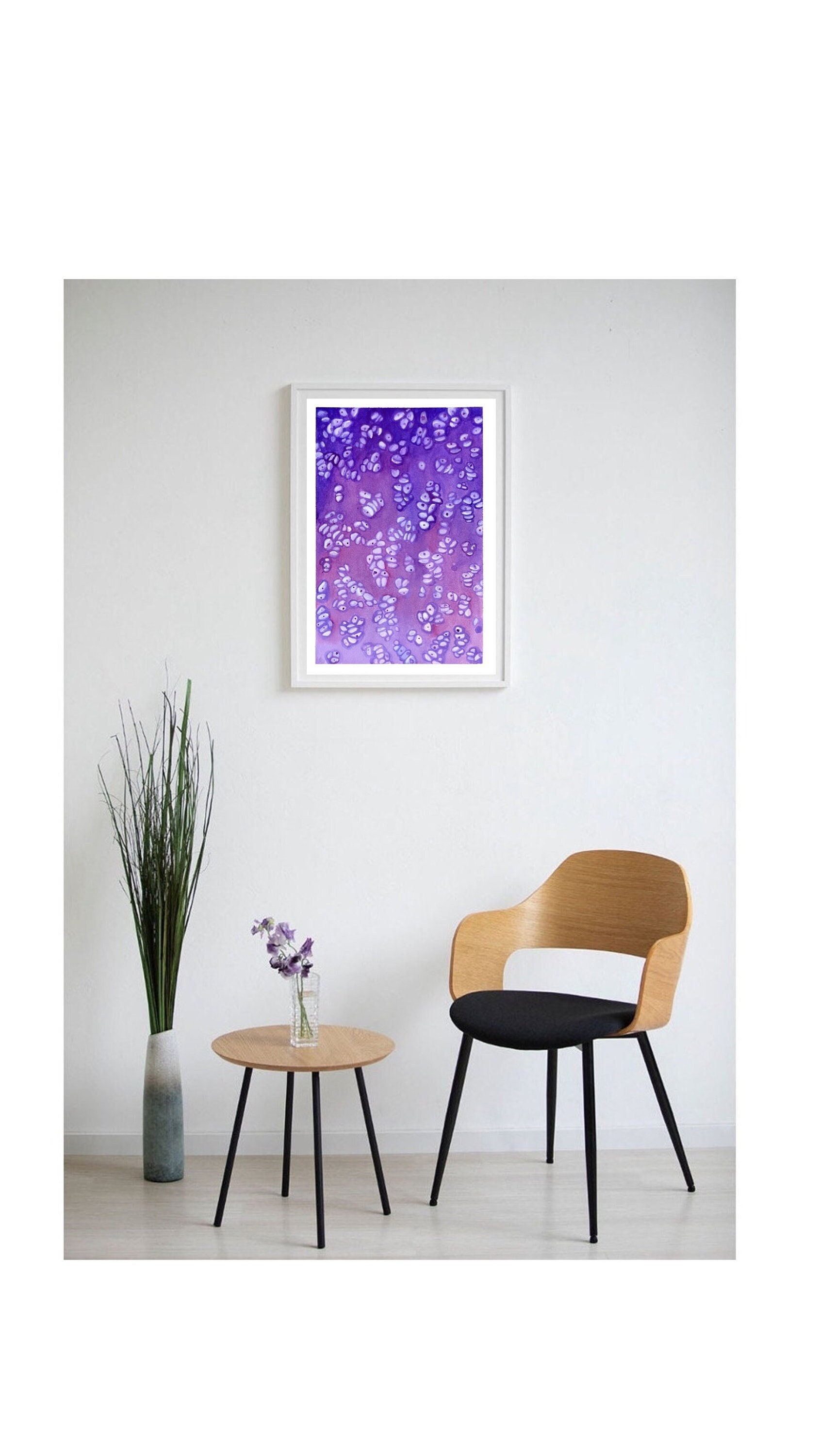 Cartilage Pathology Art Print, Bone Histology - Etsy