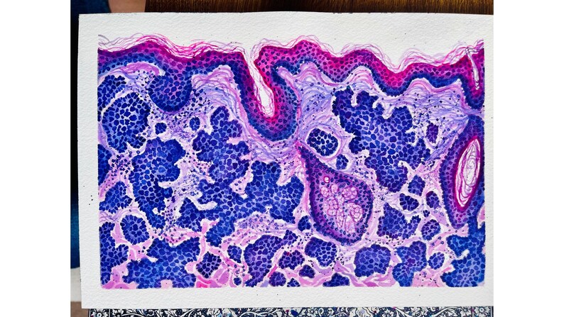 Custom Pathology Watercolor Painting, Commission Handmade Painting ...