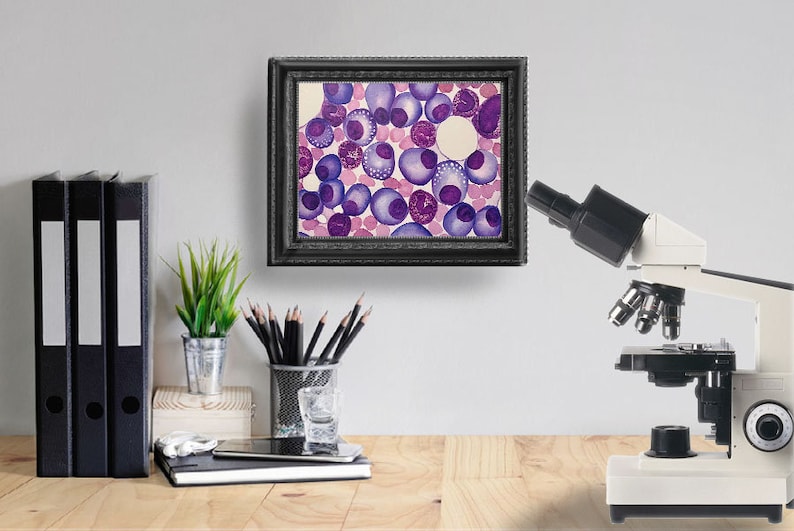 Hematopathology Art Print – Customer Favorite, Multiple Myeloma & Blood ...