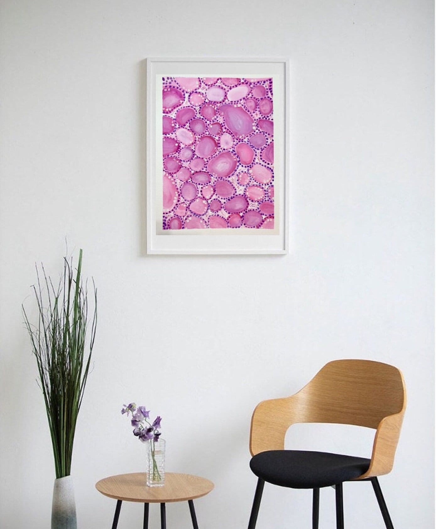 Thyroid, Pathology Art Original Painting, Watercolor and Gouache, 9x12 ...