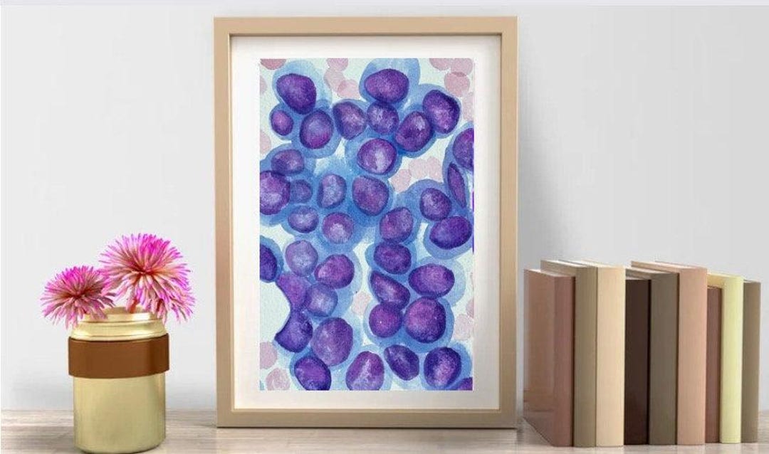 Lung Adenocarcinoma Cytology , Original Pathology Art Watercolor, 7x10 ...