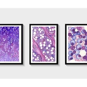 Cartilage Pathology Art Print, Bone Histology - Etsy