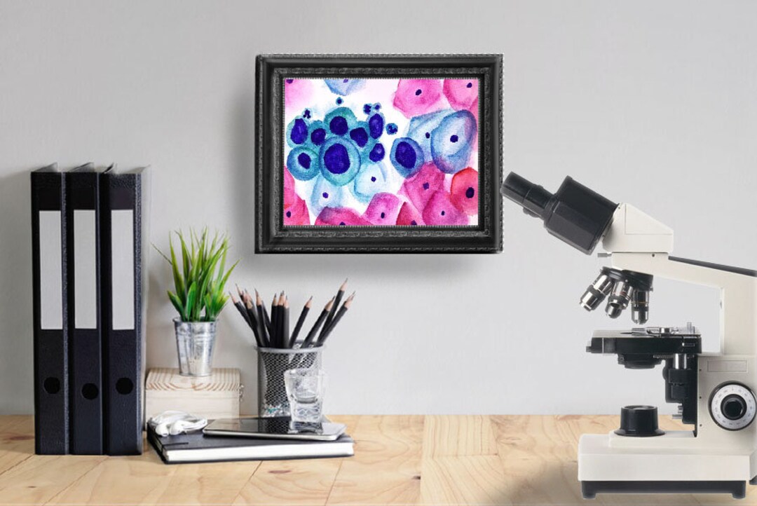 High-grade Intraepithelial Lesion (HSIL) on PAP Smear Painting Print ...