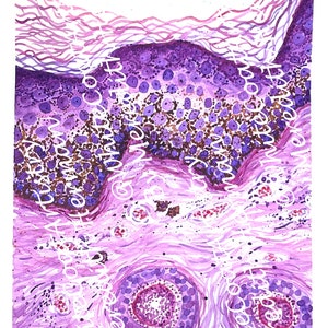 Skin Under the Microscope – Melanin, Dermatology, Pathology Art Print ...