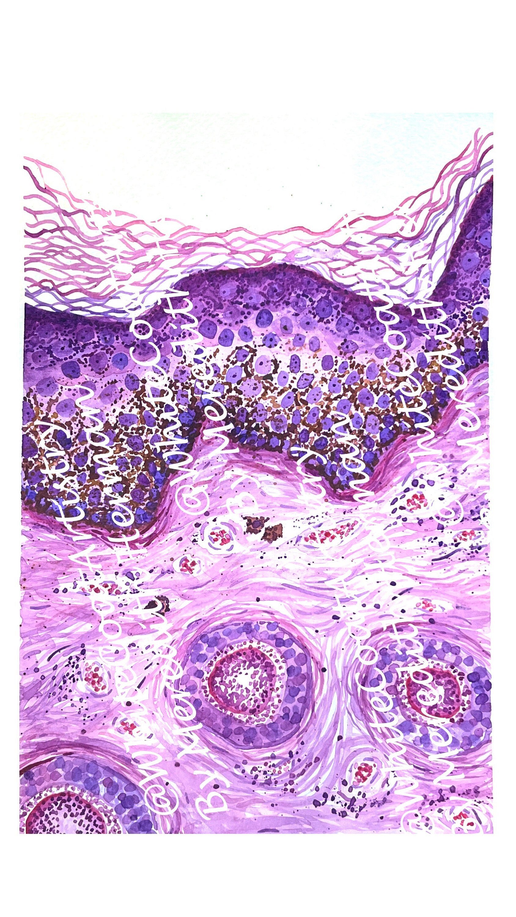 Skin Under the Microscope – Melanin, Dermatology, Pathology Art Print ...