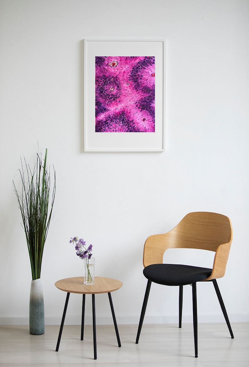 Pathology Art Print: Abstract, Brain Cancer - Etsy