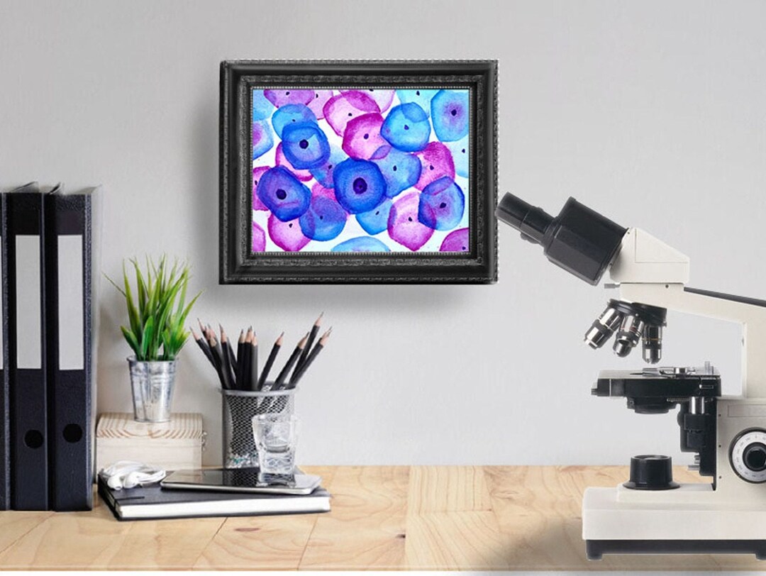 Pathology Art Print: Koilocytes PAP Smear LSIL - Etsy