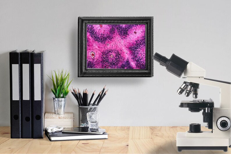 Pathology Art Print: Abstract, Brain Cancer - Etsy