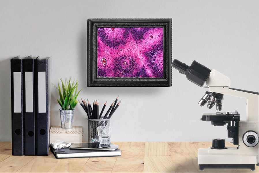 Pathology Art Print: Abstract Brain Cancer - Etsy