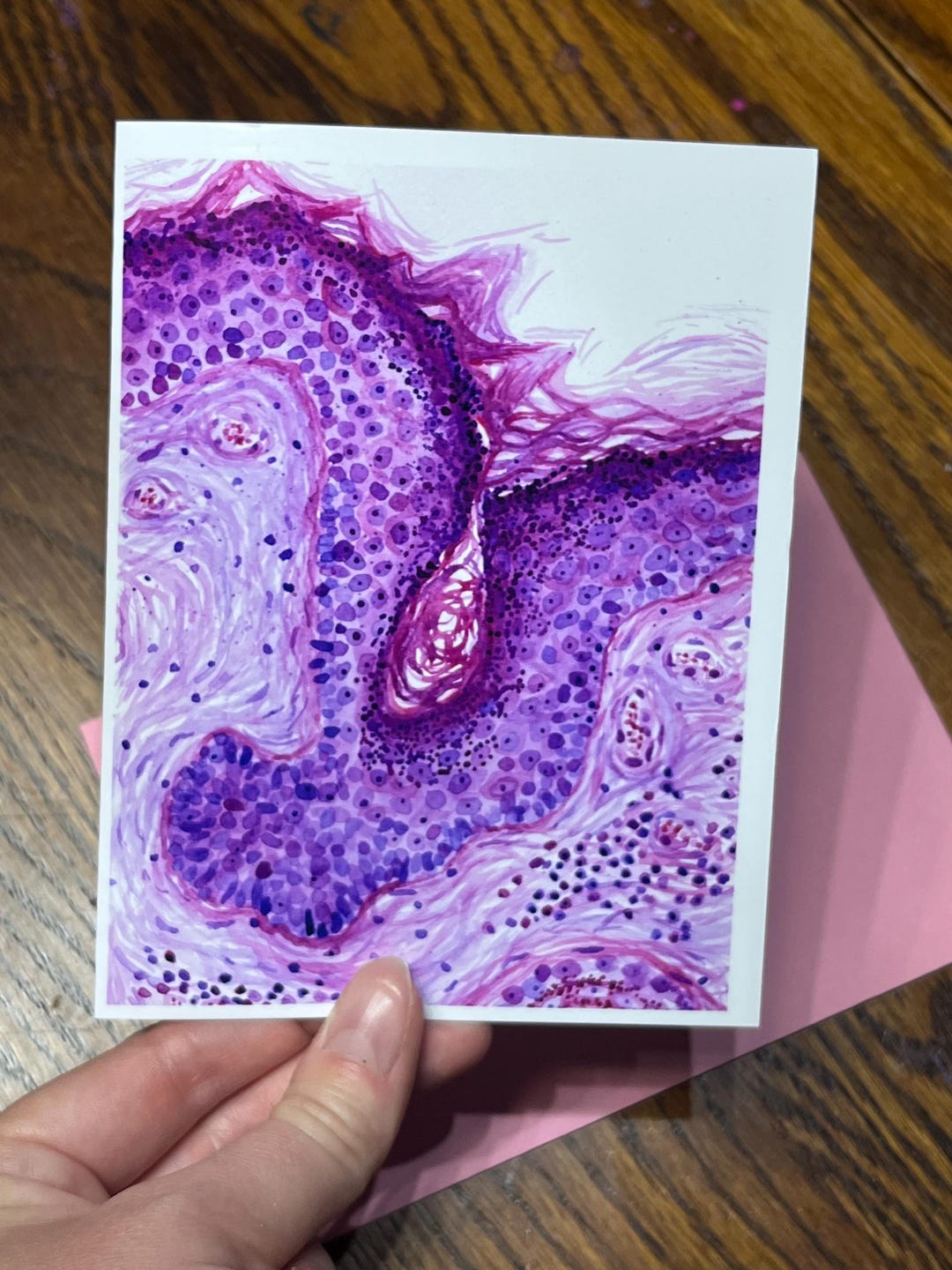 Dermatology Card With Envelope, 4x6 - Etsy