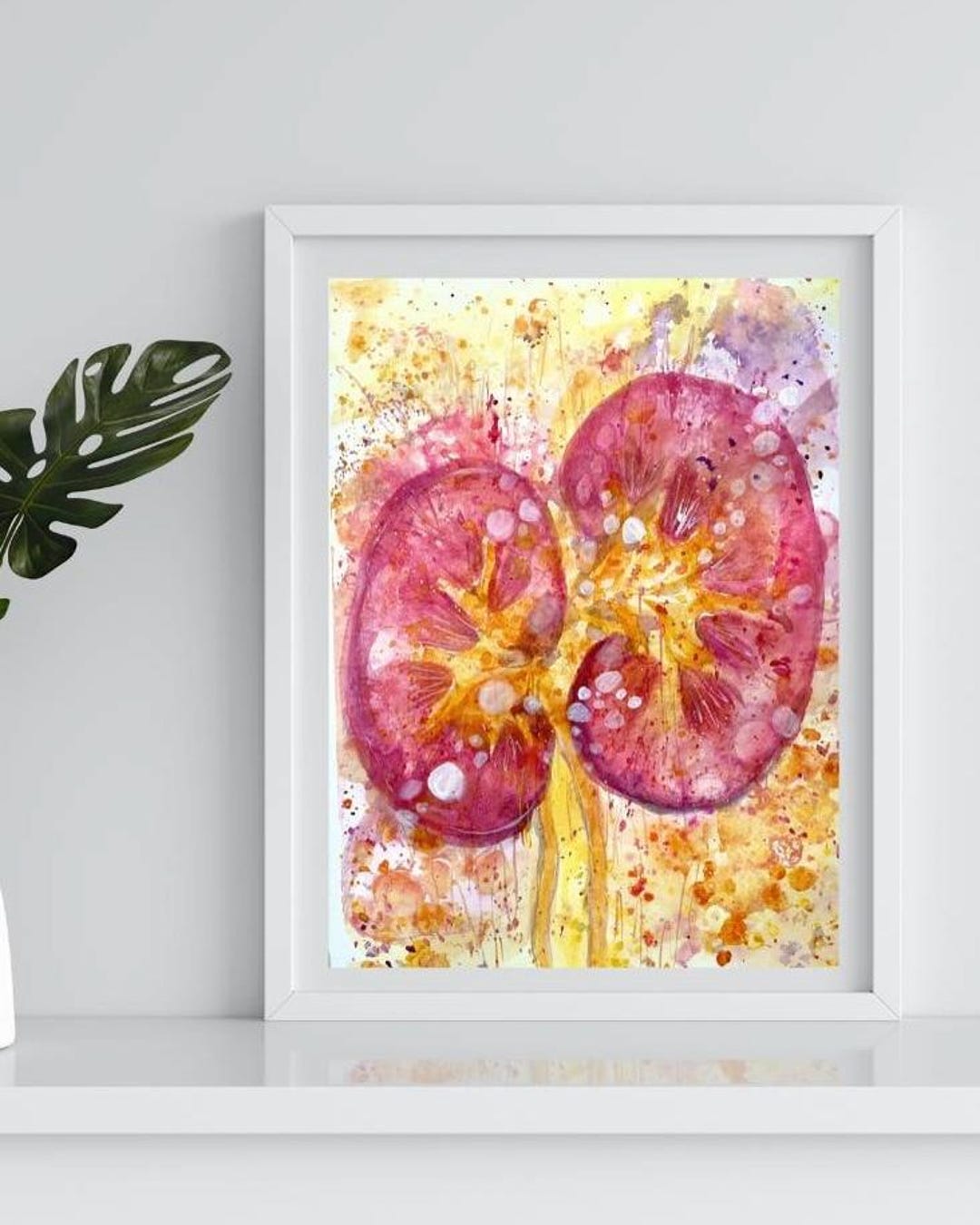Kidney, Pathology Art Original Painting, Watercolor, 9x12" - Etsy