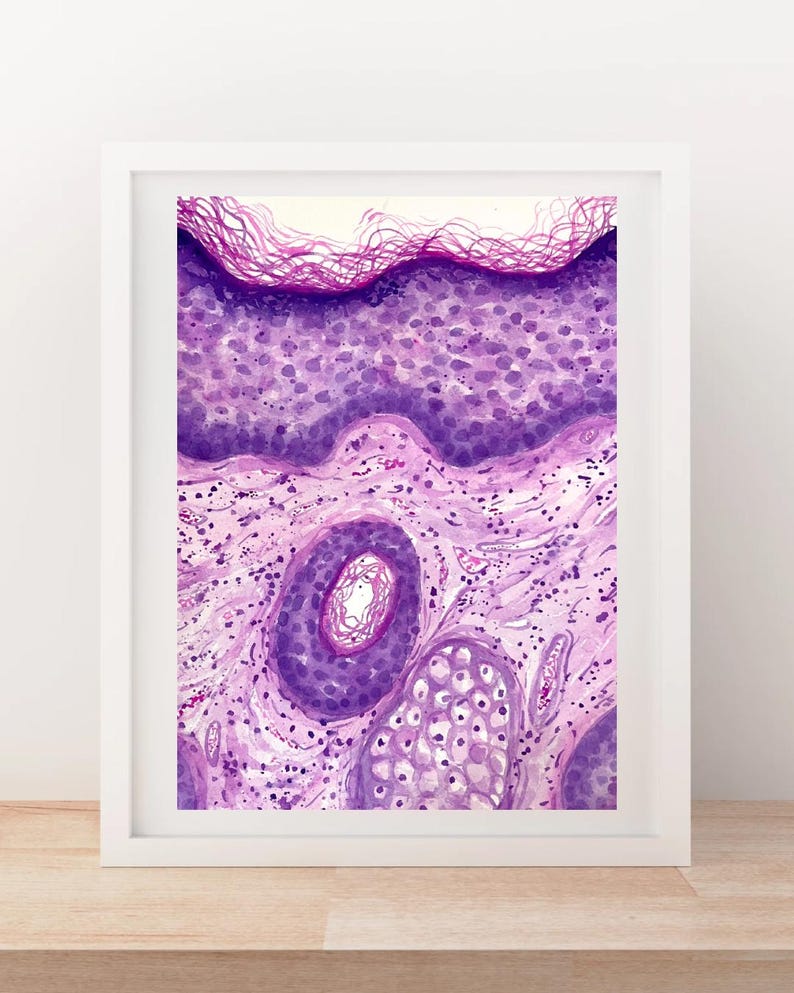 Skin Histology, Pathology Art Original Painting, Watercolor, 9x12" - Etsy