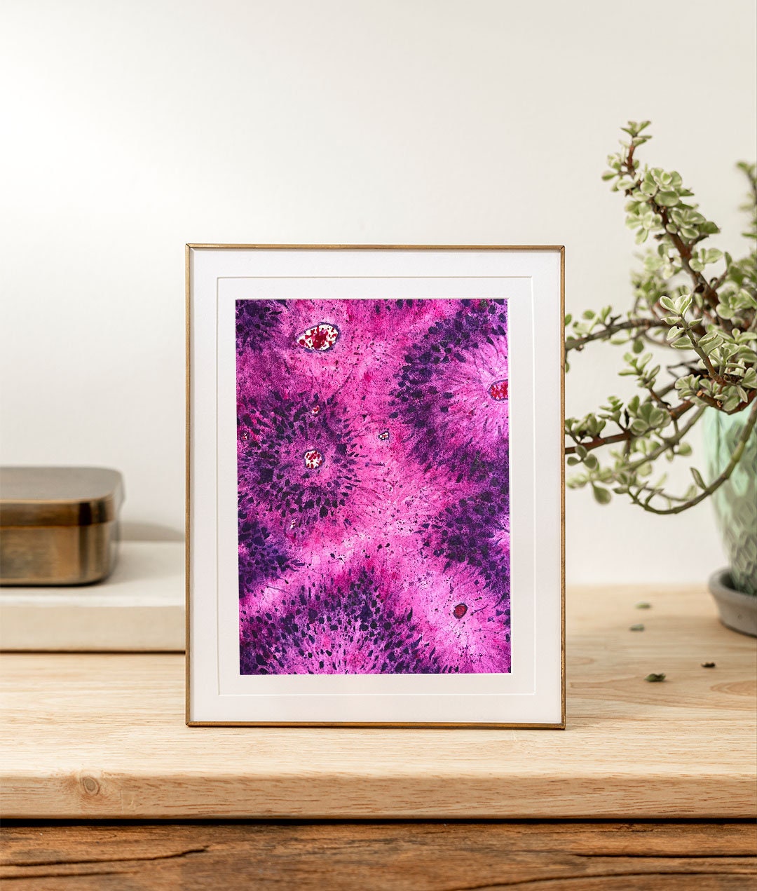 Pathology Art Print: Abstract, Brain Cancer - Etsy