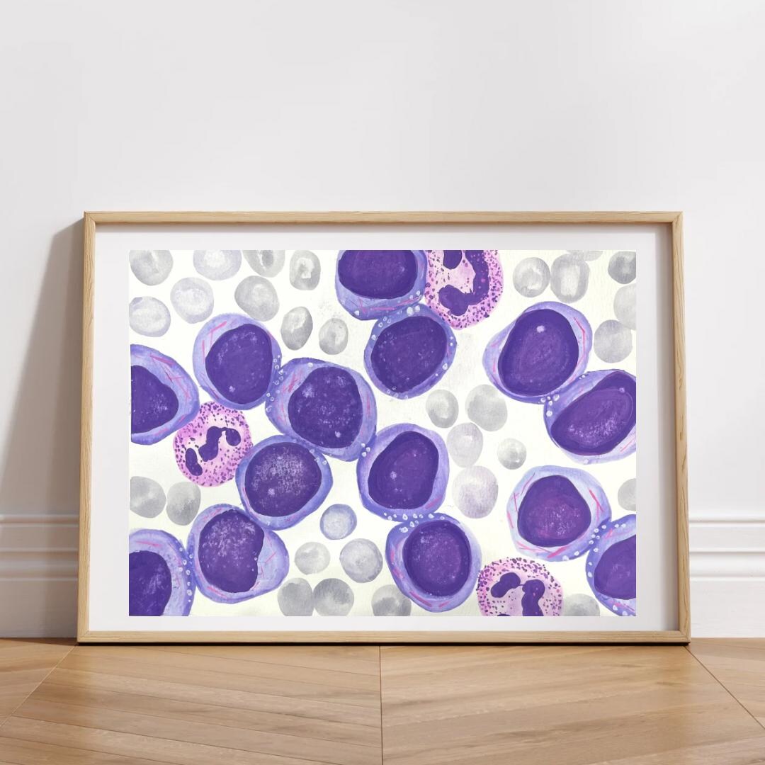 Blasts in Blood Smear, Pathology Art, 9x12 Gouache - Etsy