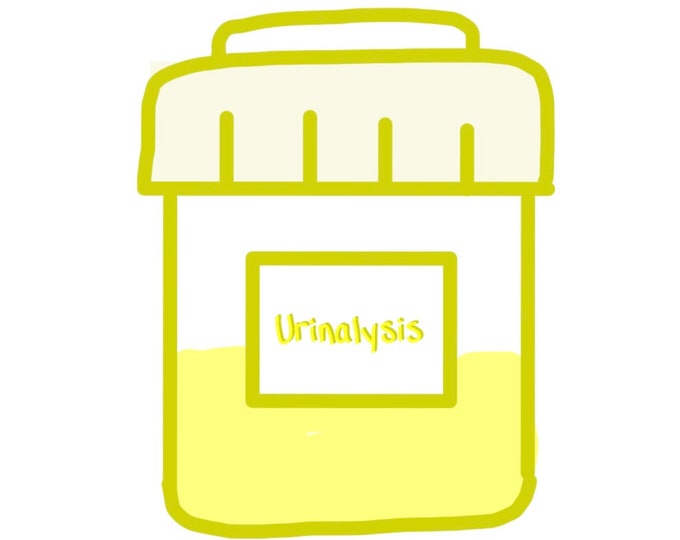 Printable Urinalysis Sheet Download - Etsy