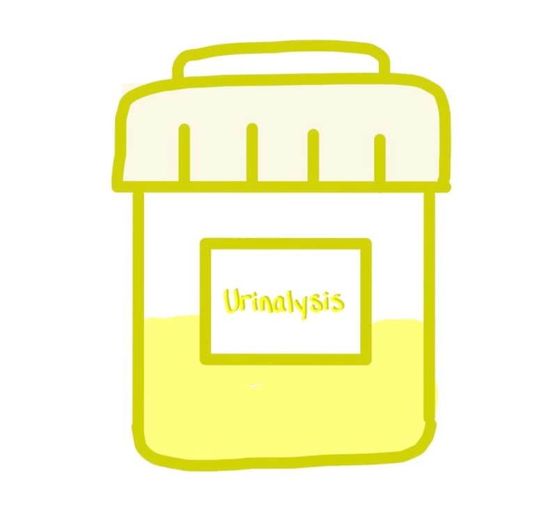 Medical Laboratory Science Urinalysis and Body Fluids Digital Notes - Etsy