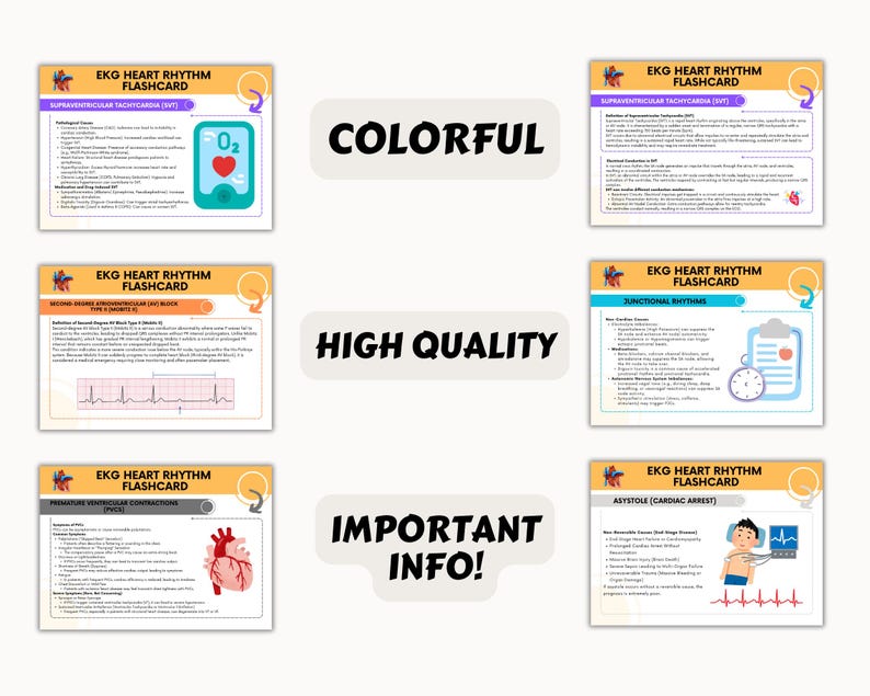 200+ EKG and Heart Rhythm Flashcards, EKG Study Guide, ECG or Ekg ...