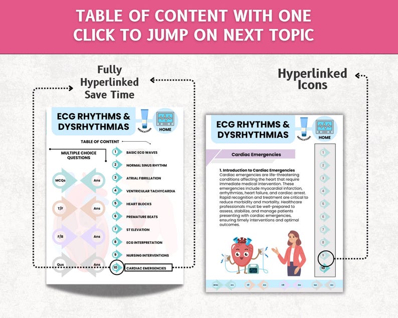 EKG & Dysrhythmias Study Guide Hyperlinked, 180+ Pages With Strips ...