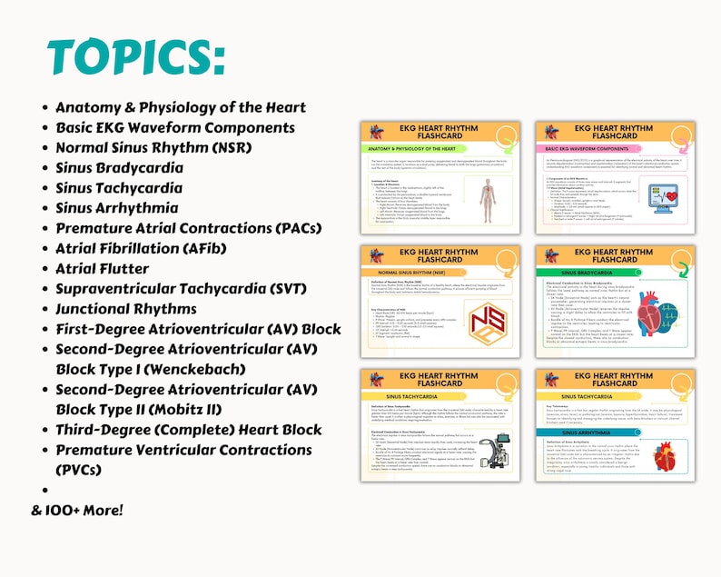 200+ EKG and Heart Rhythm Flashcards, EKG Study Guide, ECG or Ekg ...