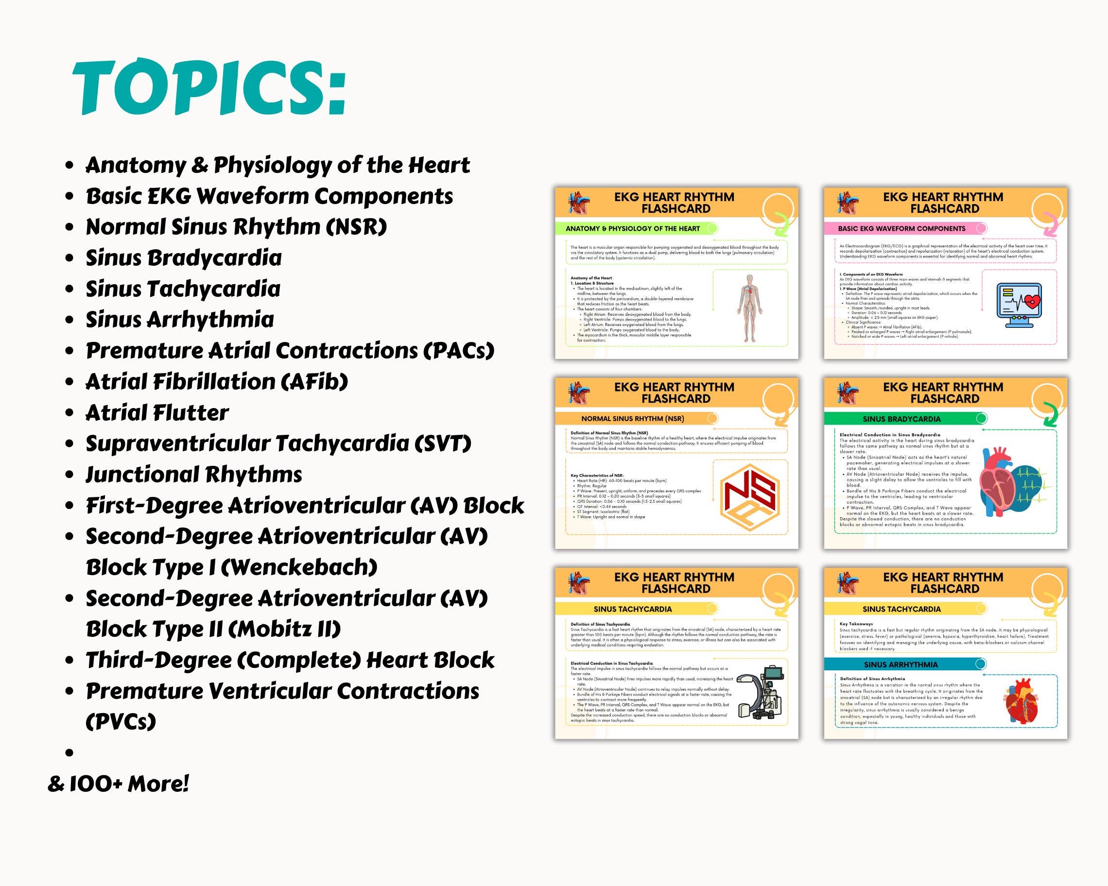 200+ EKG and Heart Rhythm Flashcards, EKG Study Guide, ECG or Ekg ...