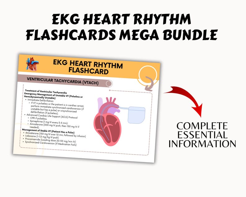 200+ EKG and Heart Rhythm Flashcards, EKG Study Guide, ECG or Ekg ...