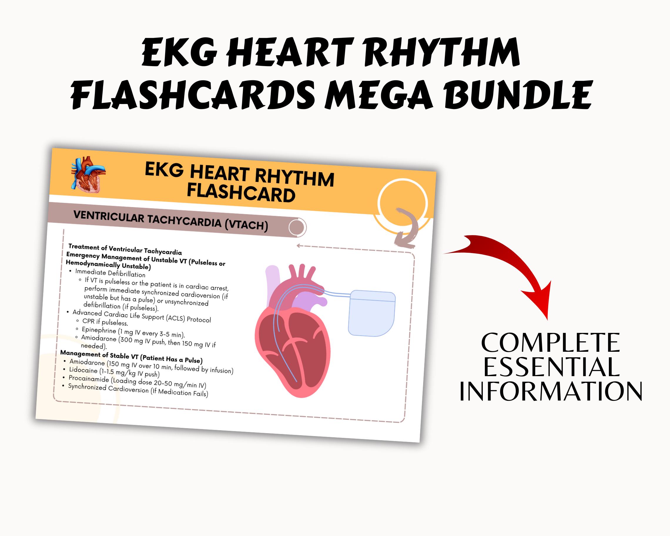 200+ EKG and Heart Rhythm Flashcards, EKG Study Guide, ECG or Ekg ...