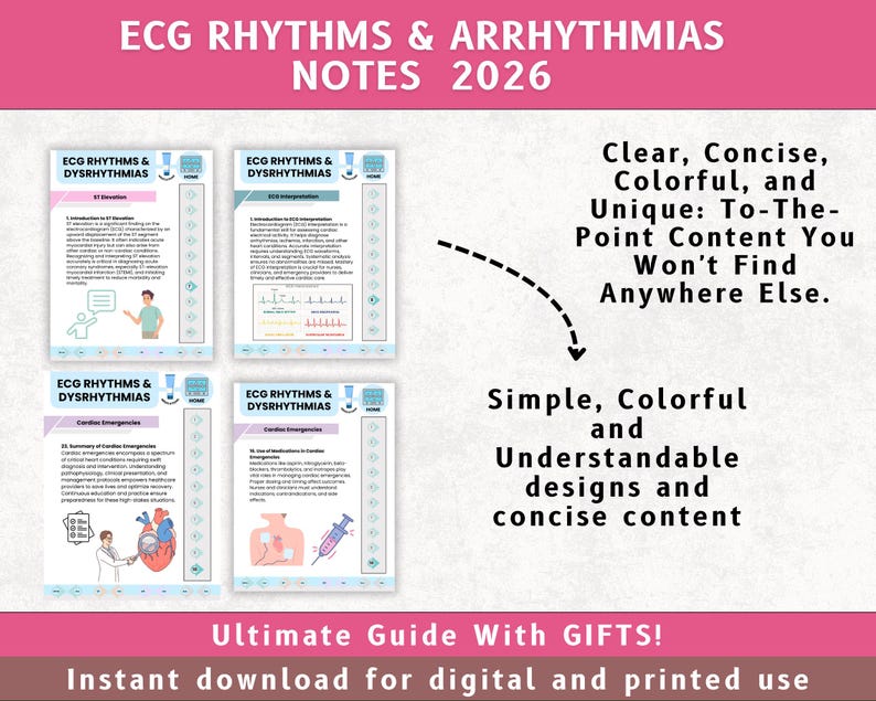 EKG & Dysrhythmias Study Guide Hyperlinked, 180+ Pages With Strips ...