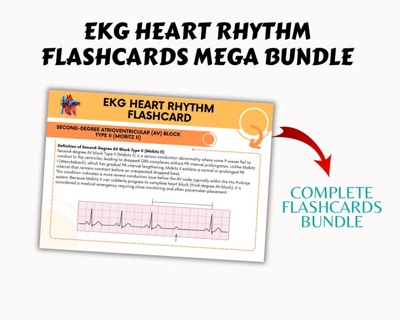 200+ EKG and Heart Rhythm Flashcards, EKG Study Guide, ECG or Ekg Interpretation, Cardiac Study ...
