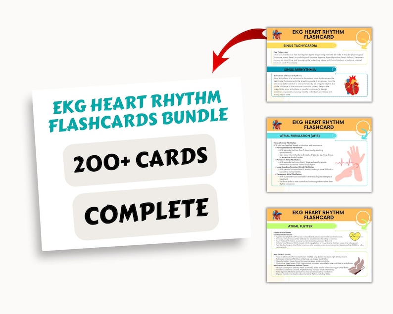 200+ EKG and Heart Rhythm Flashcards, EKG Study Guide, ECG or Ekg ...