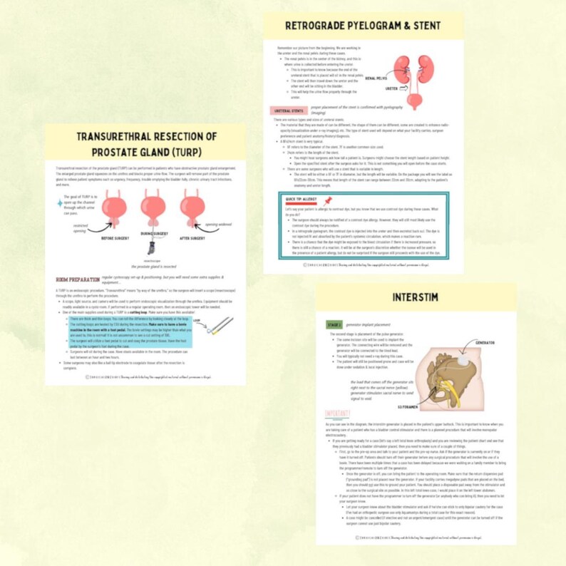 Guide to Urologic Surgery | Surgical Guide | Surgery | Digital Download ...