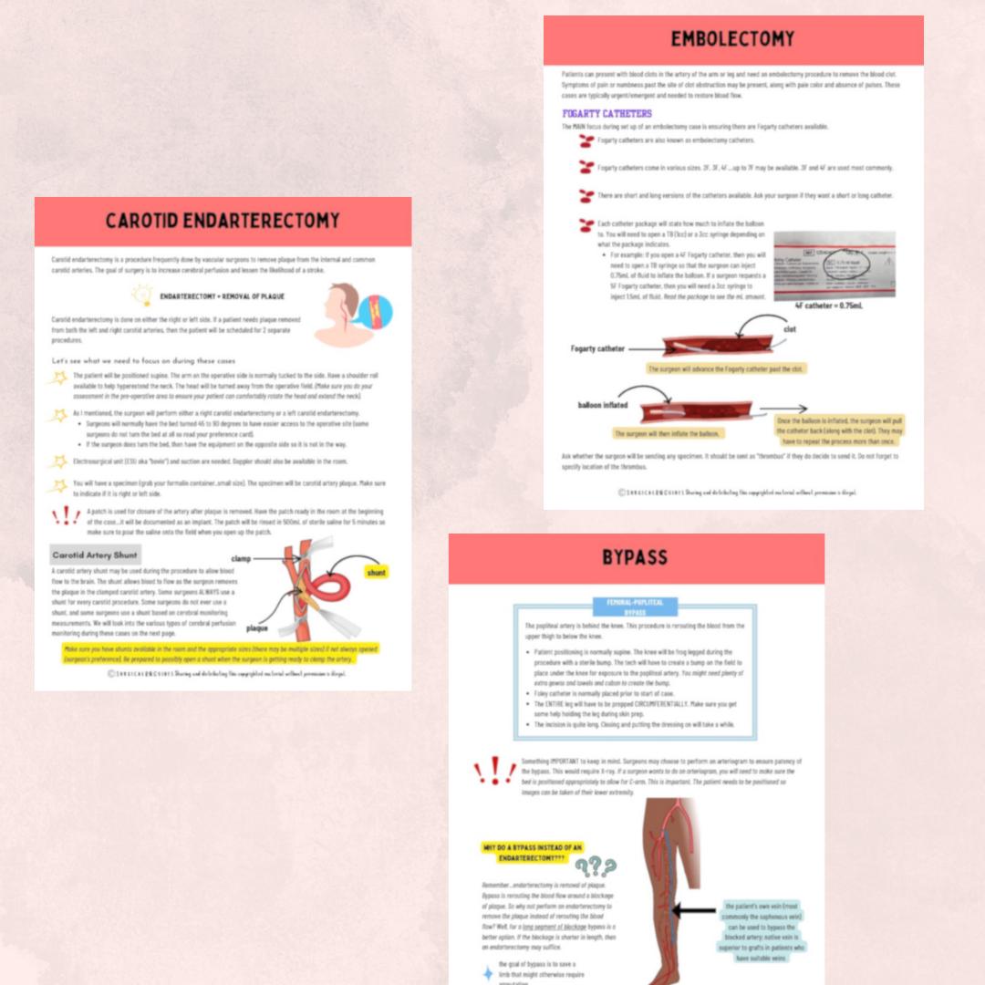 Guide to Vascular Surgery | Surgical Guide | Surgery | Digital Download ...
