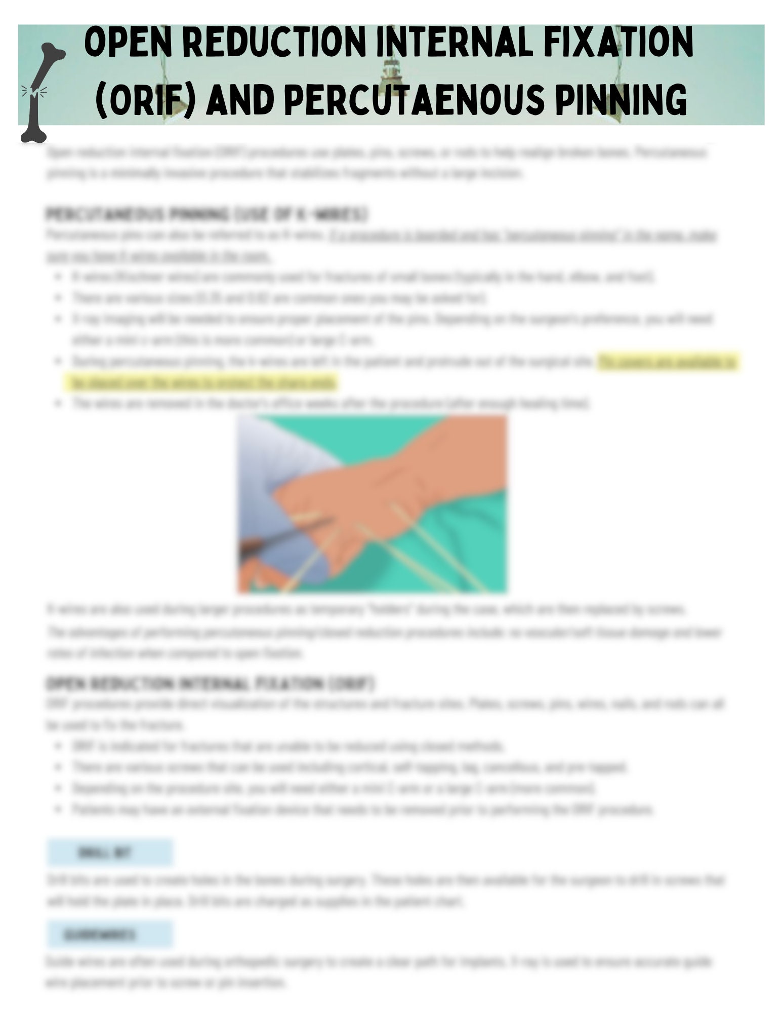 Guide to Orthopedic Surgery Surgical Guide Surgery Digital Download ...