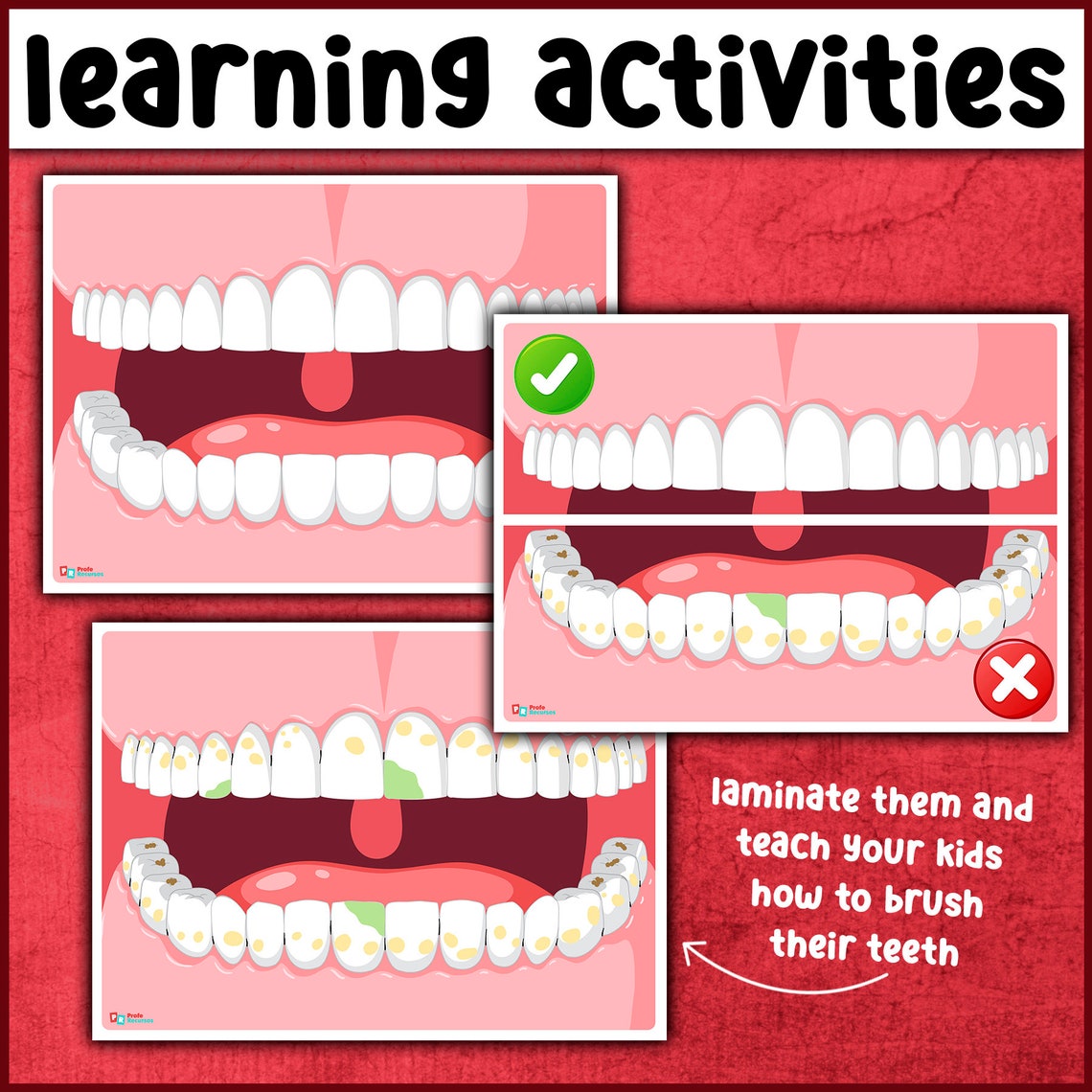 Brush Your Teeth Activity Bundle Learn to Brush Your Teeth Activity ...
