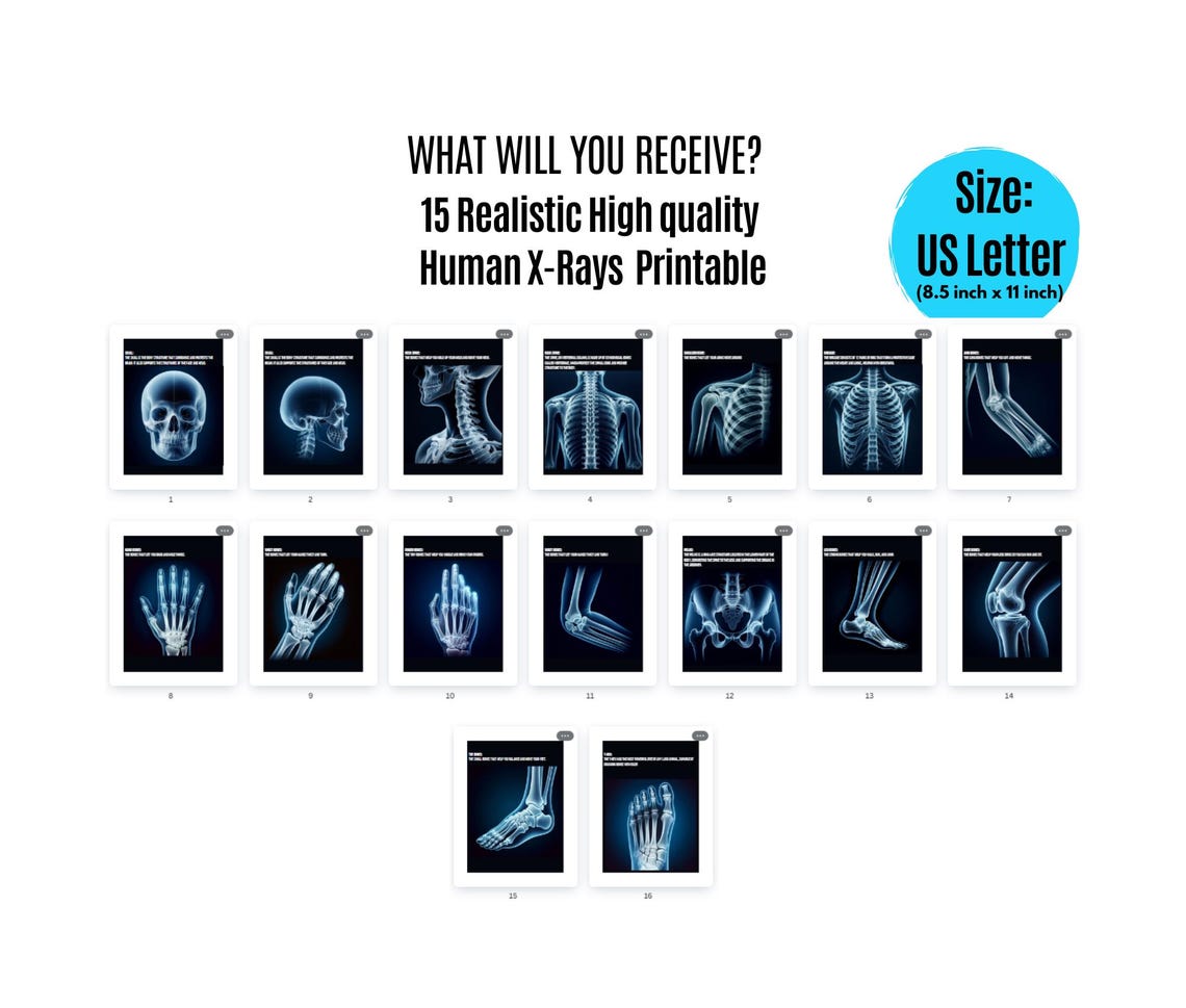 Human Anatomy Printable Activity for Kids | Human Body X-rays Activity ...