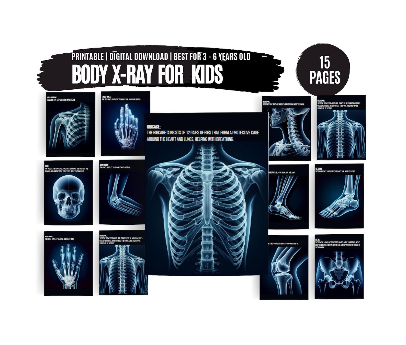 Human Body X-rays Printable Activity: Kids Pretend Play (digital ...